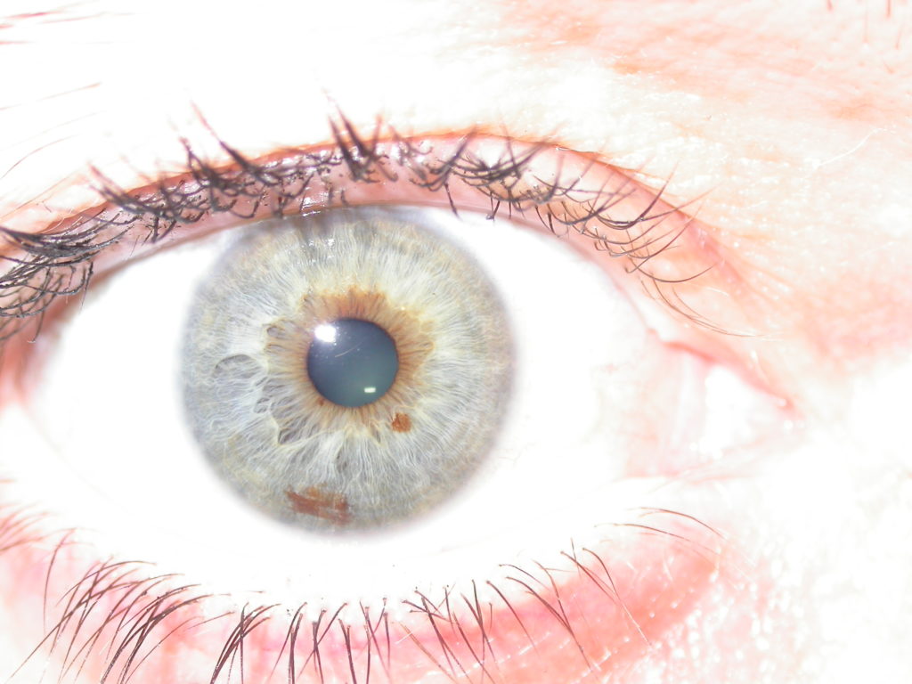 Formation Iridologie - cours bilans de santé AEMN - reconnu