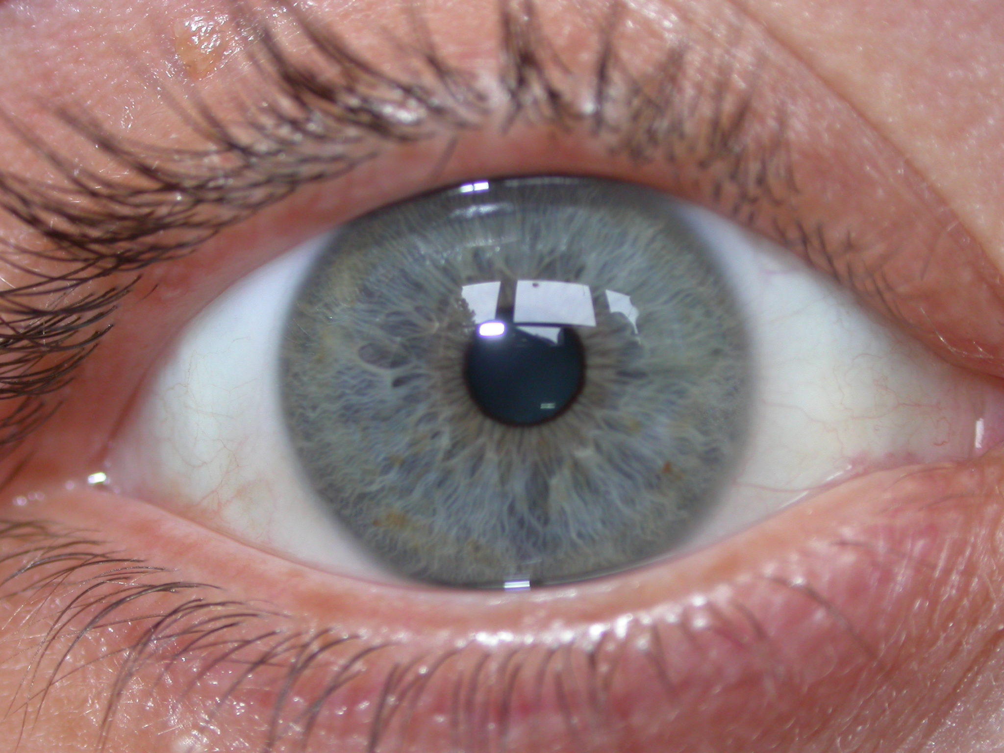 Comment nous enseignons l'iridologie - formation qualité N°1